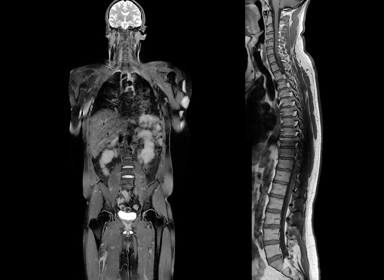 Whole Body MRI Scan BAMF Health